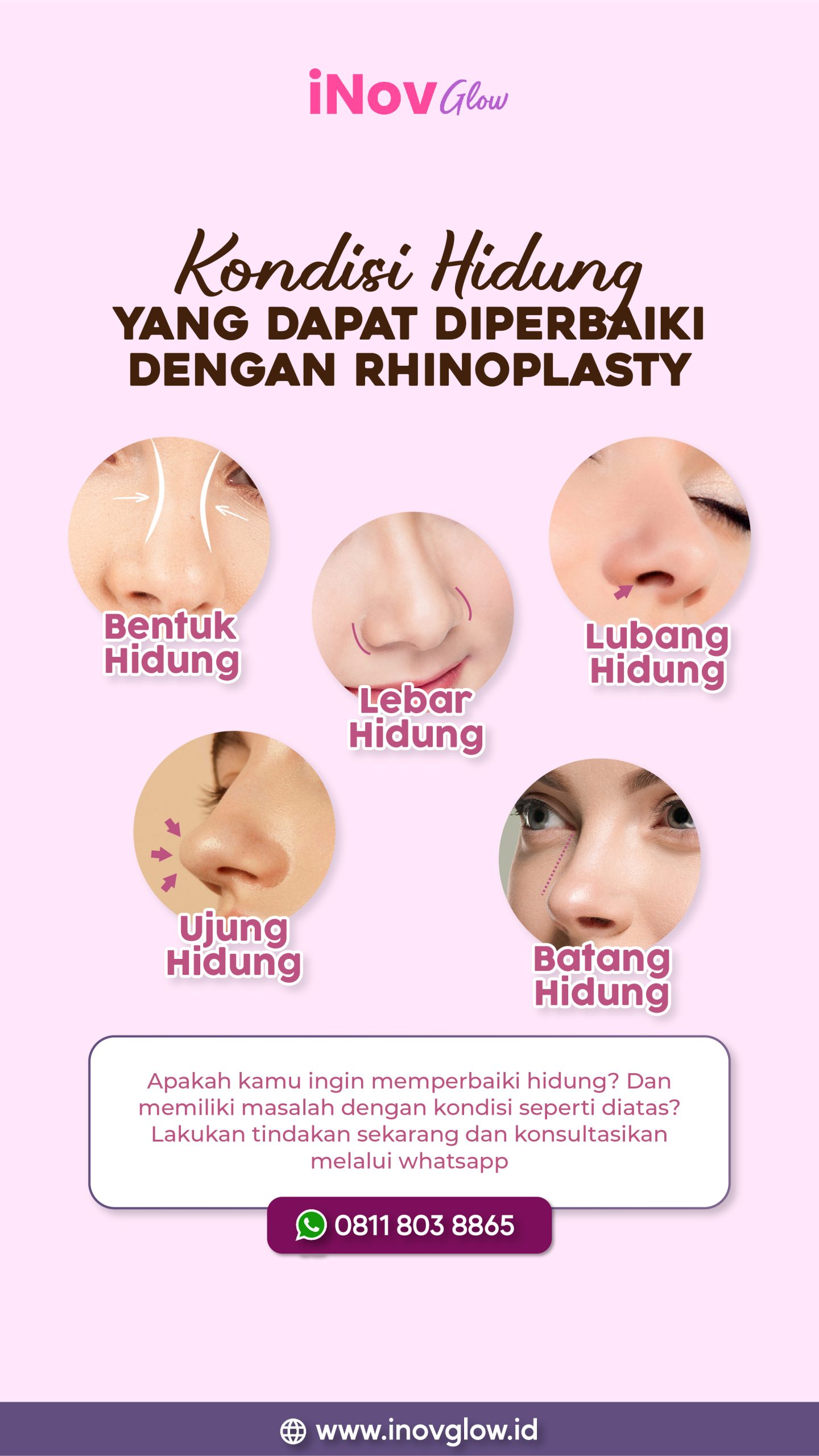 MENGENAL TAHAPAN PROSEDUR REVISI HIDUNG - INOVGLOW - KLINIK SPESIALIS BEDAH PLASTIK TERBAIK