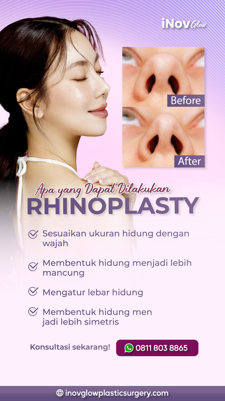 MENGENAL TAHAPAN PROSEDUR REVISI HIDUNG - INOVGLOW - KLINIK SPESIALIS BEDAH PLASTIK TERBAIK