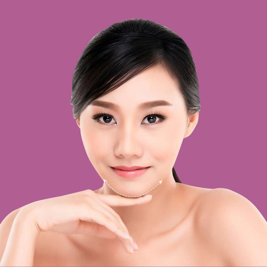 Sulam Dagu: Menjawab Tantangan Mempunyai Dagu Yang Lebih Menarik - iNOV ...