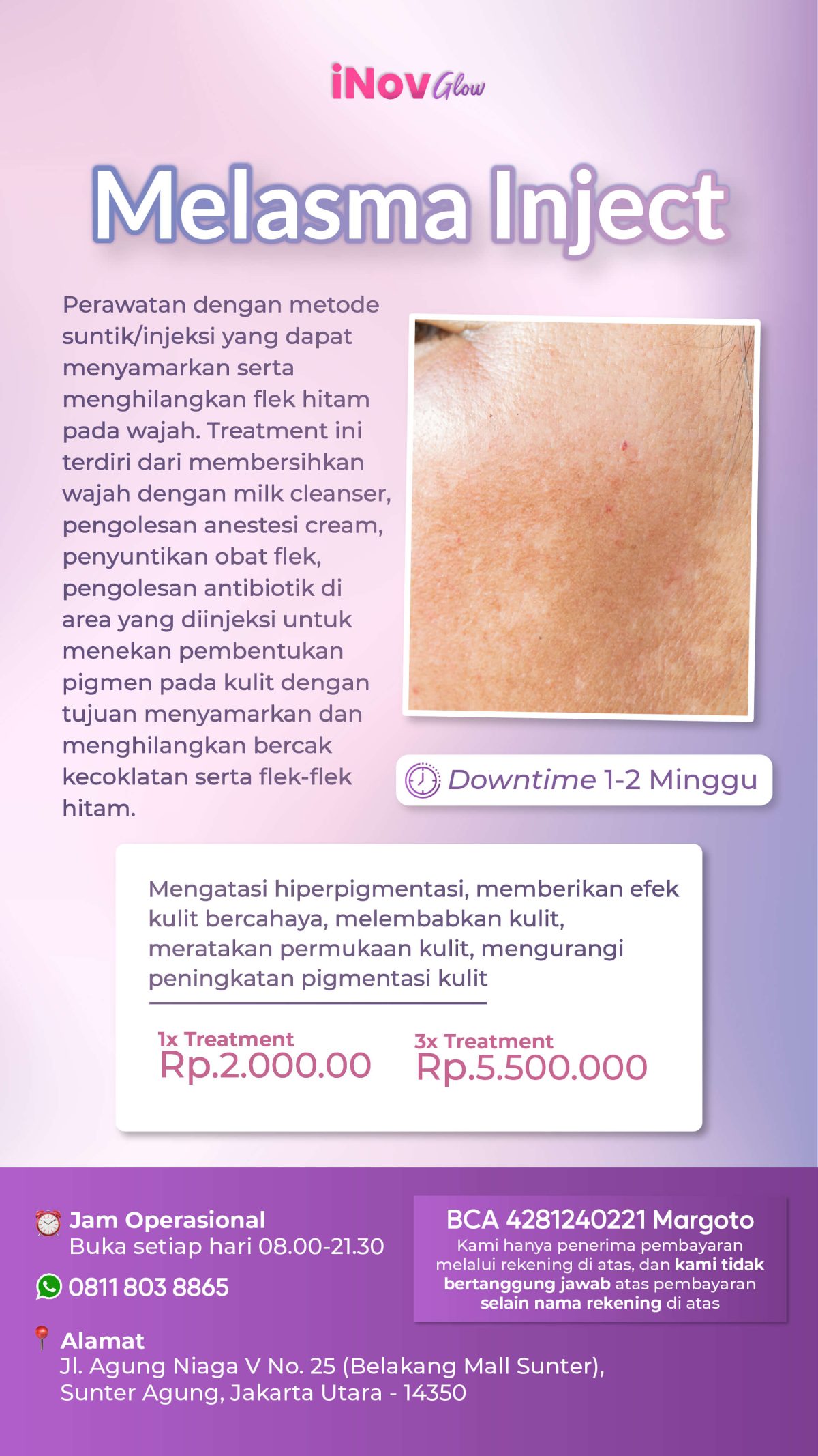 Perawatan Melasma Yang Aman Selama Kehamilan Di Klinik Inov Glow ...