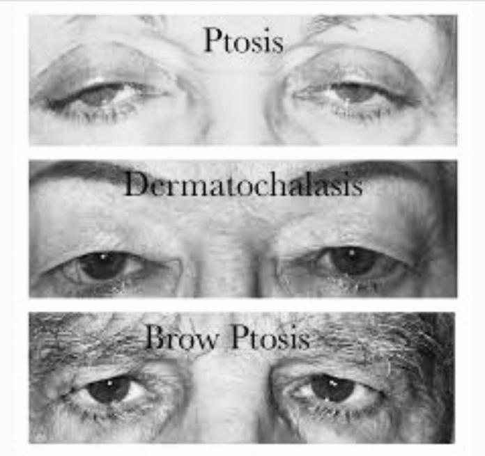 MATA TERLIHAT MENUA? - iNOV GLOW