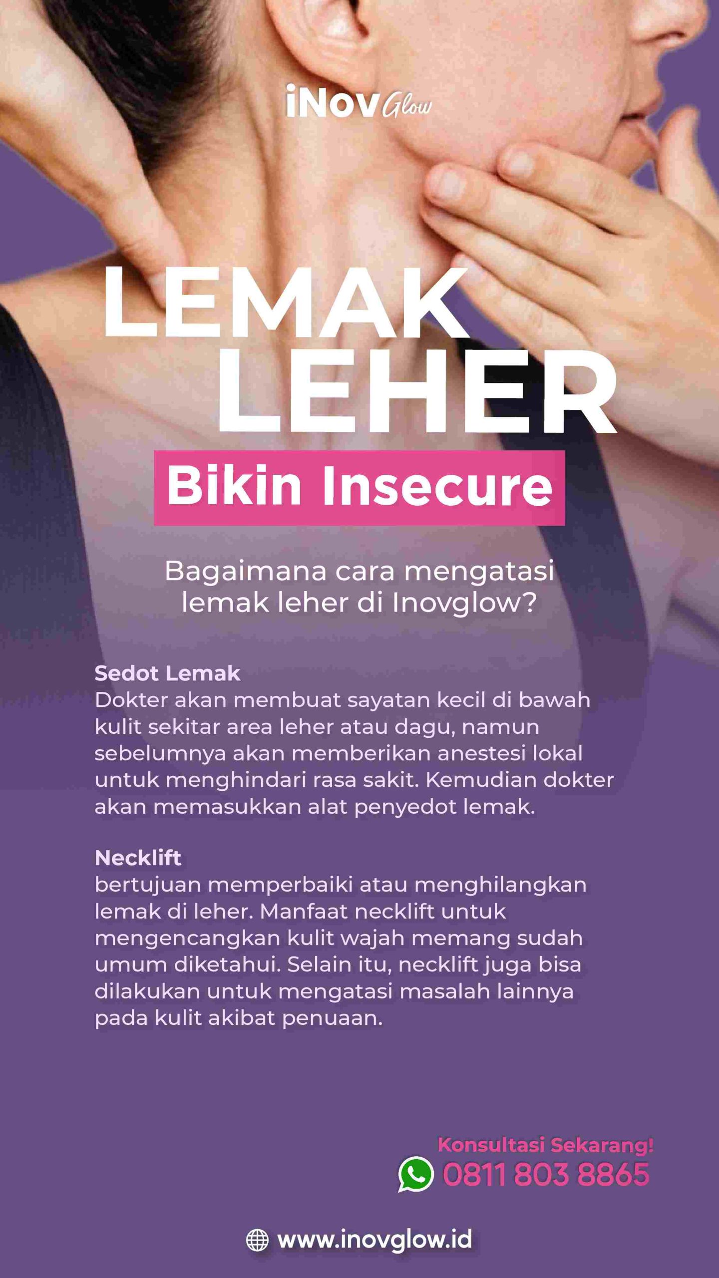 Berbagai Macam Teknik Untuk Menghilangkan Double Chin Yang Mengganggu ...